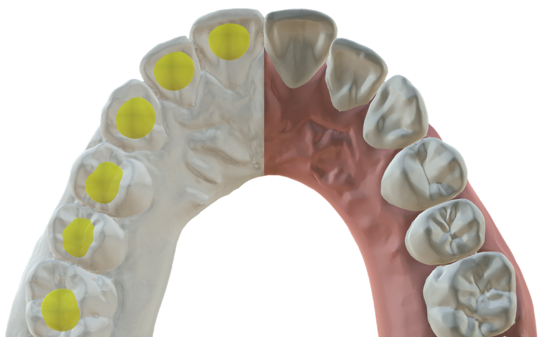 ArchForm - Simple, powerful 3D software to setup aligner cases