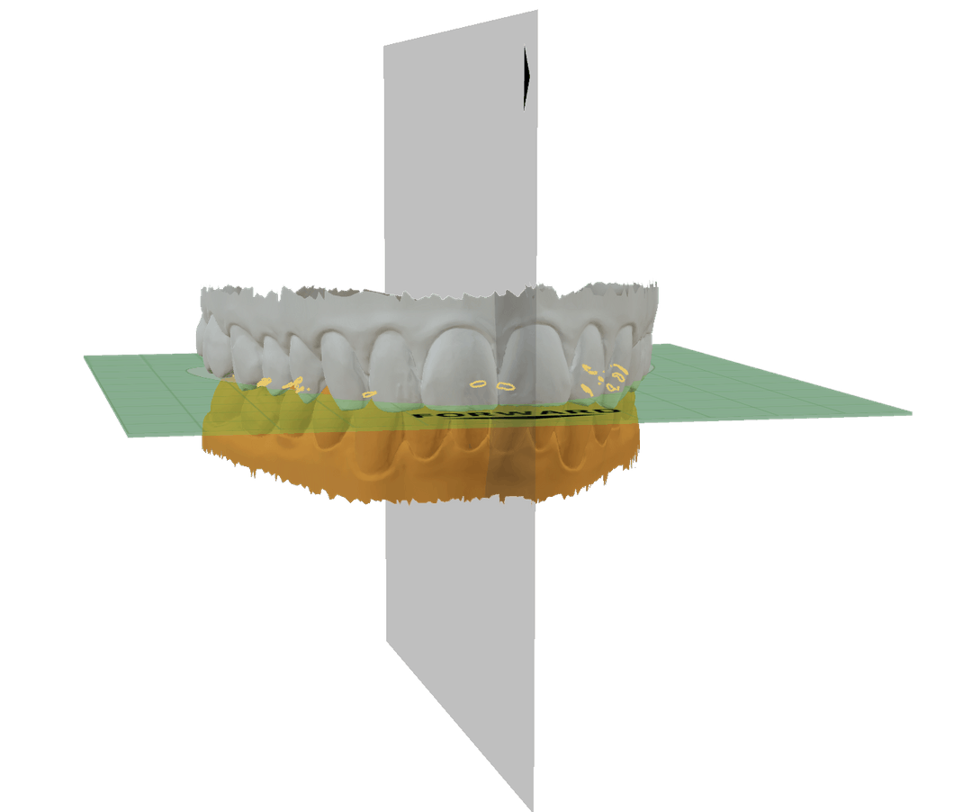 ArchForm - Simple, powerful 3D software to setup aligner cases