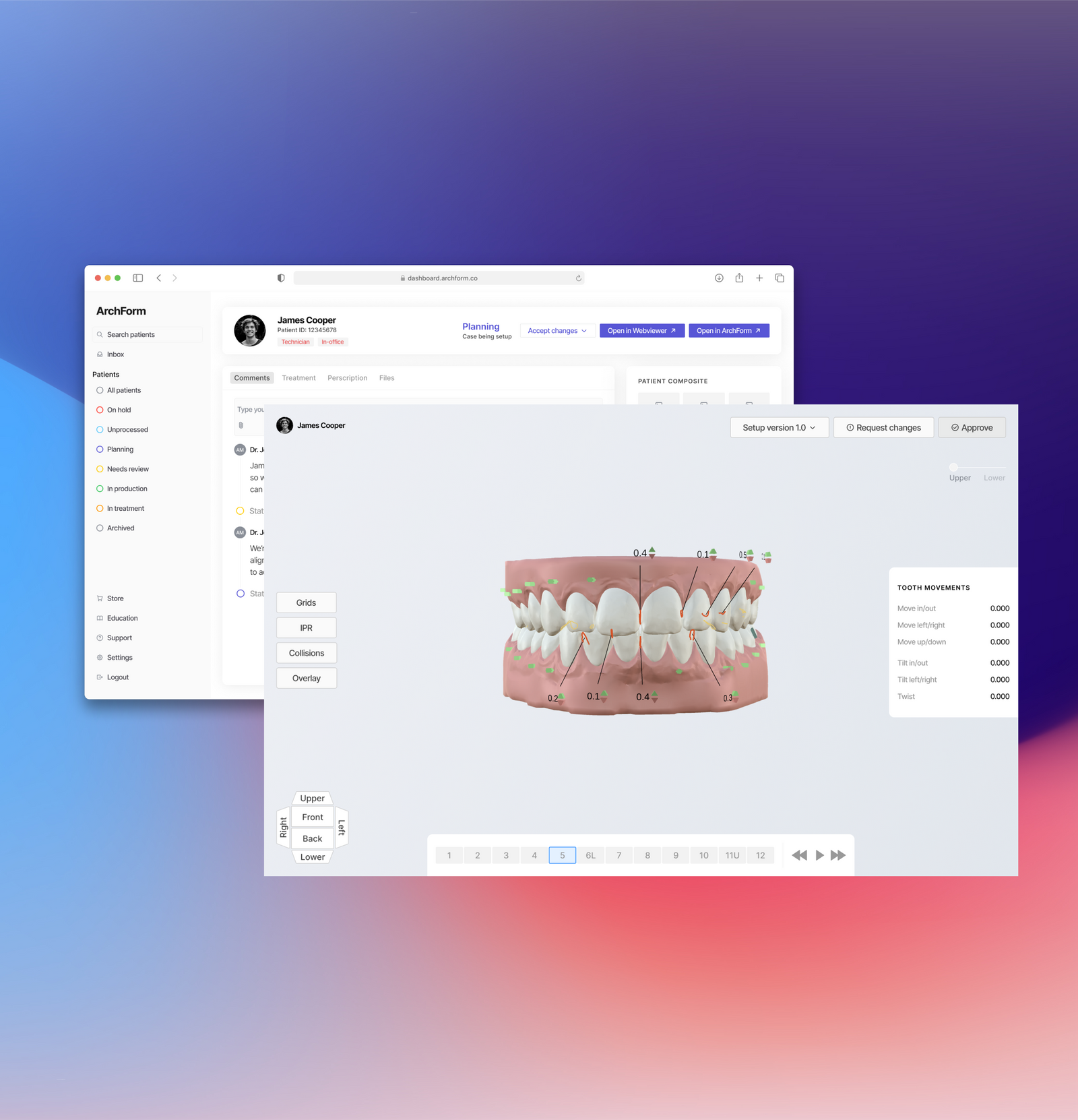 ArchForm - Simple, powerful 3D software to setup aligner cases