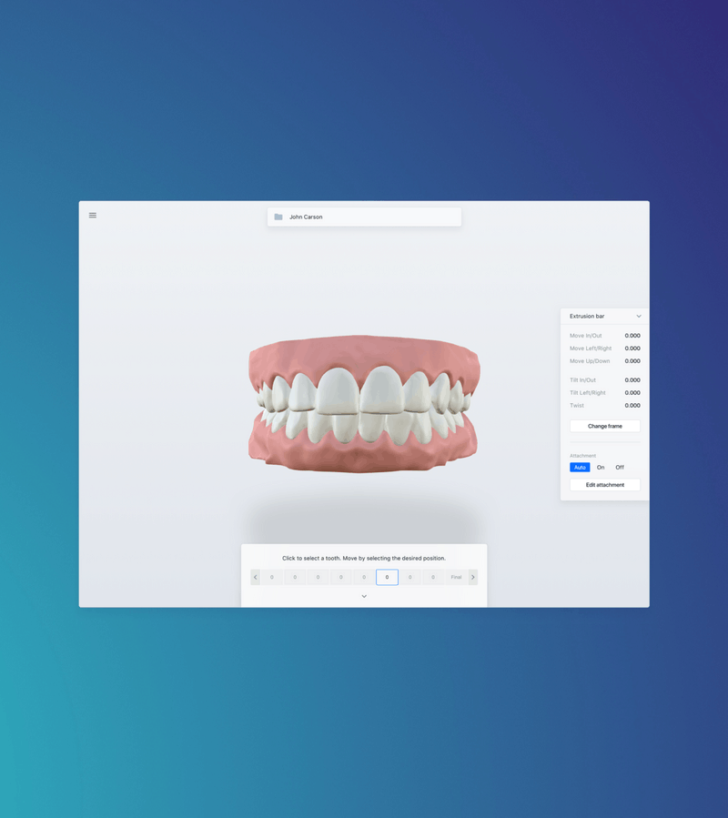 ArchForm - Form Aligners