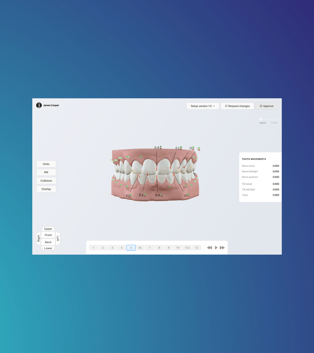 ArchForm - Simple, powerful 3D software to setup aligner cases