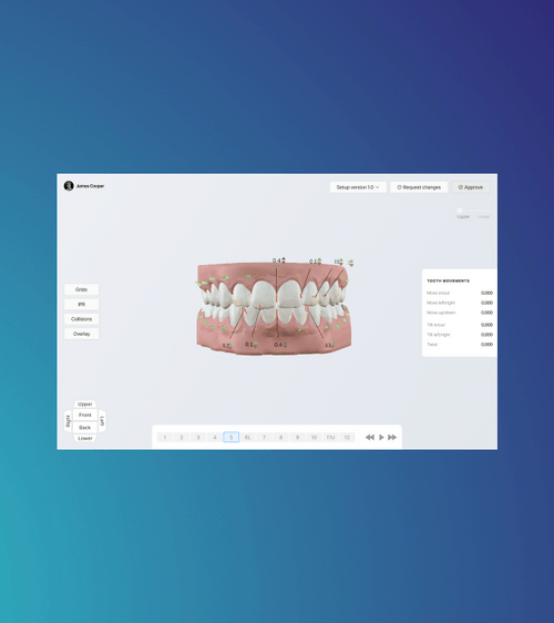 ArchForm - Simple, powerful 3D software to setup aligner cases