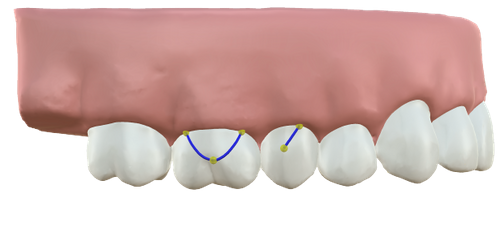 ArchForm - Simple, powerful 3D software to setup aligner cases