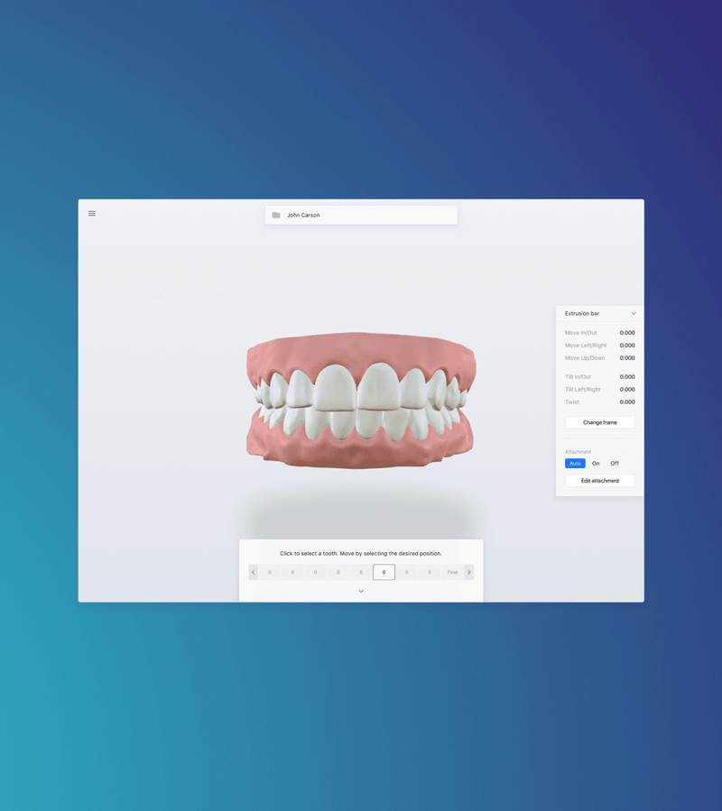 ArchForm - Simple, powerful 3D software to setup aligner cases