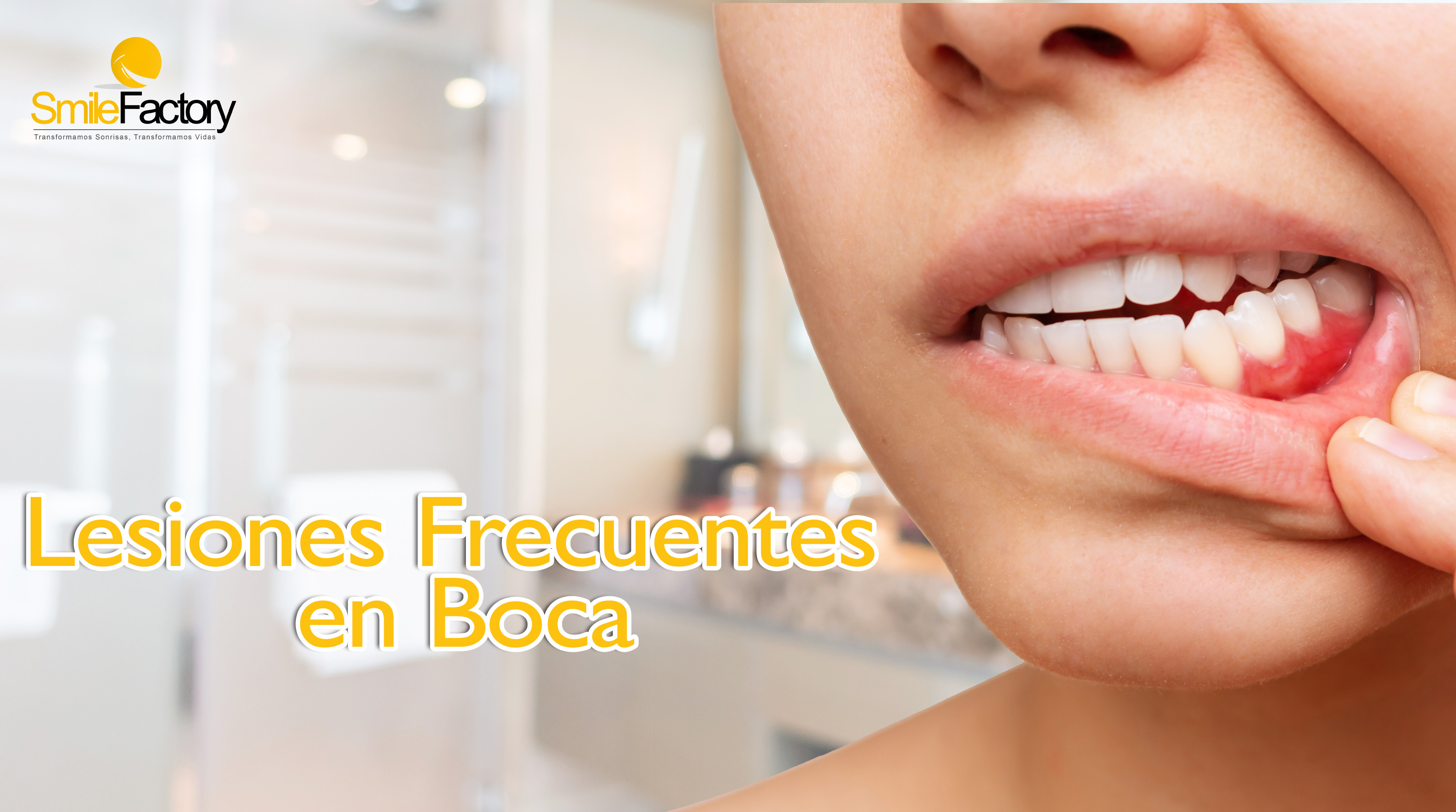 Smile Factory | ¡Alerta! Lesiones en boca que te indican hay problemas ...
