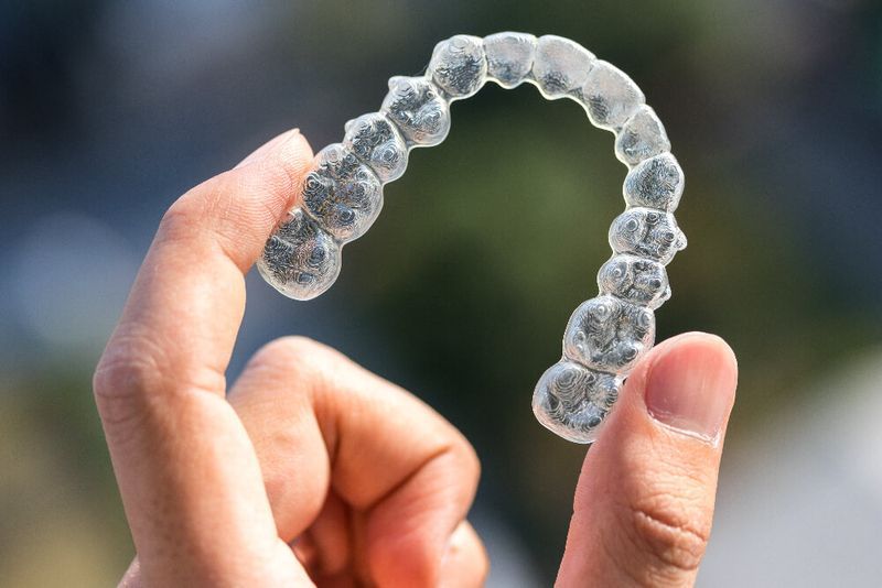 How Do Invisalign Attachments Work? | Skylyn Dental Associates
