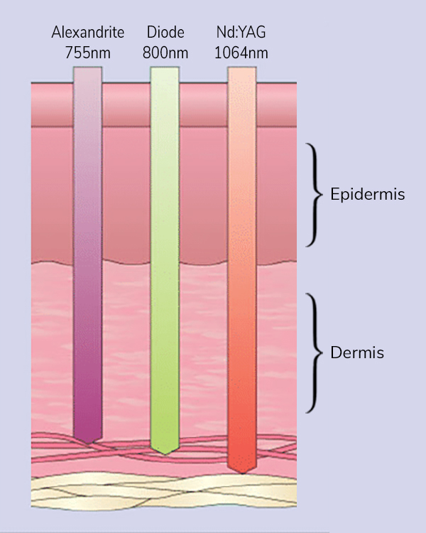 Aesthetica Professional - Laser Hair Removal