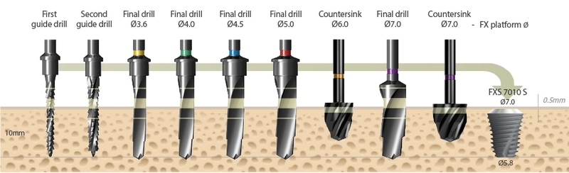 SuperLine Implants