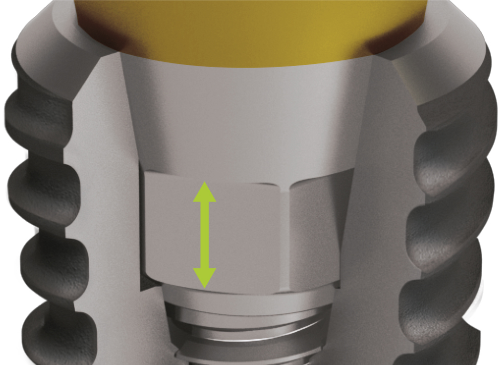 SuperLine II Implants