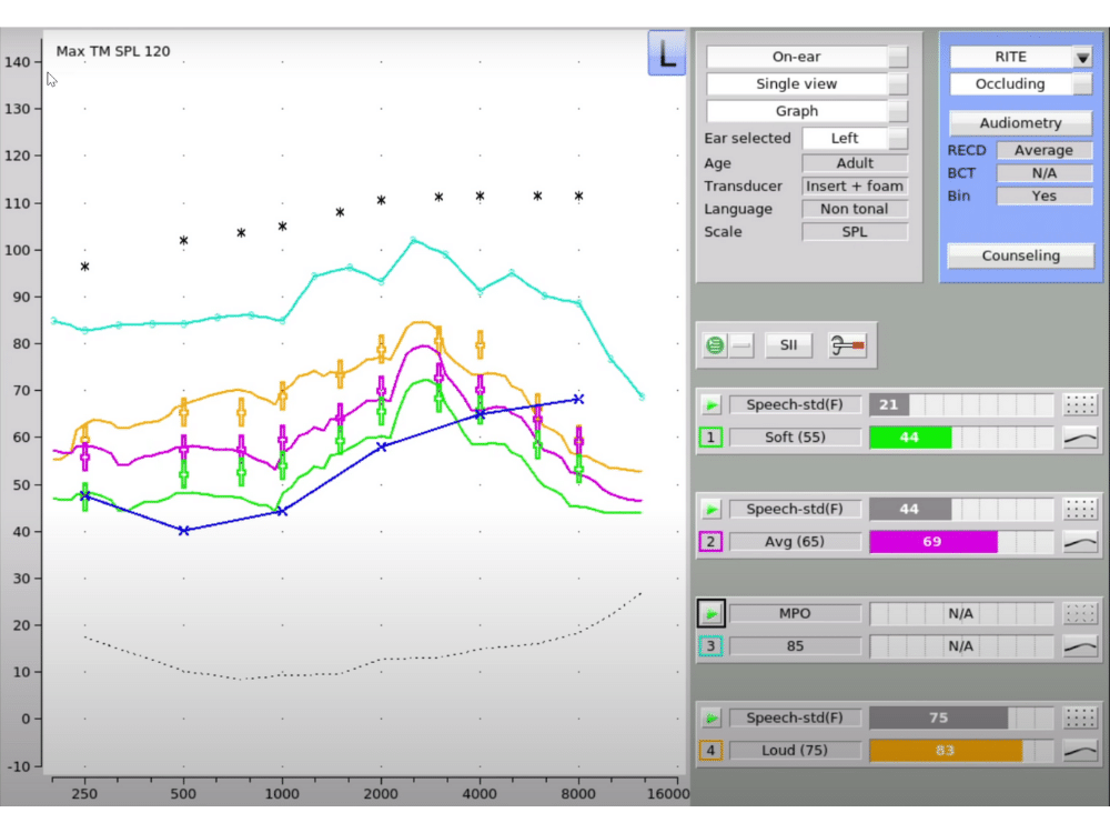 Audicus Wave Hearing Aid Review by Audiologist