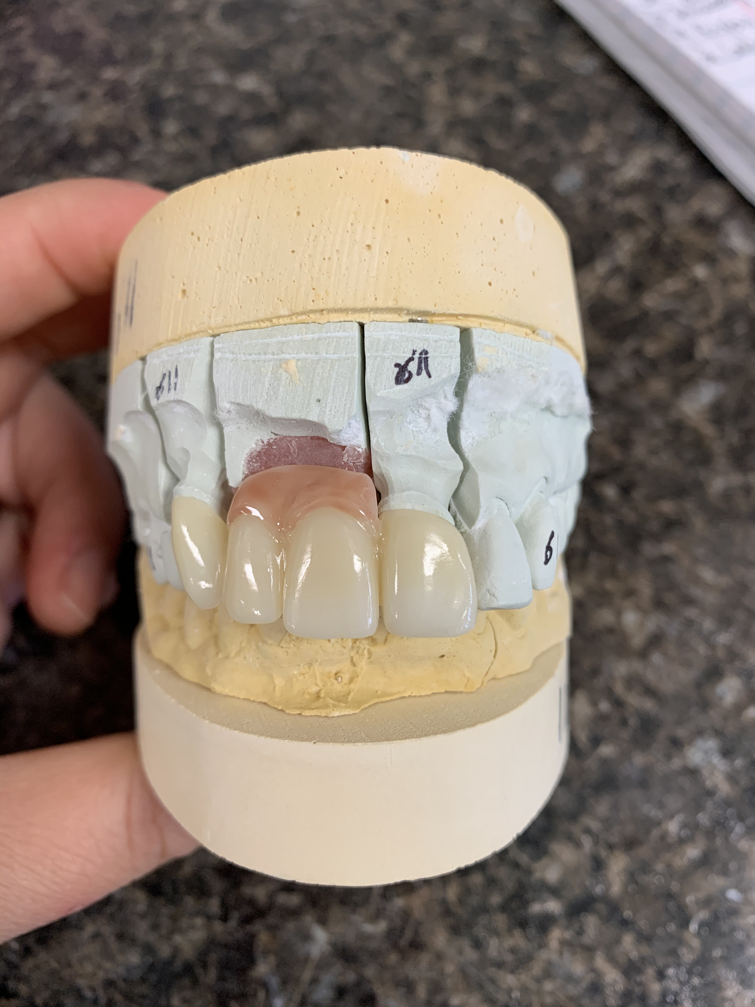 One Dental Labs - Harrisonburg, VA