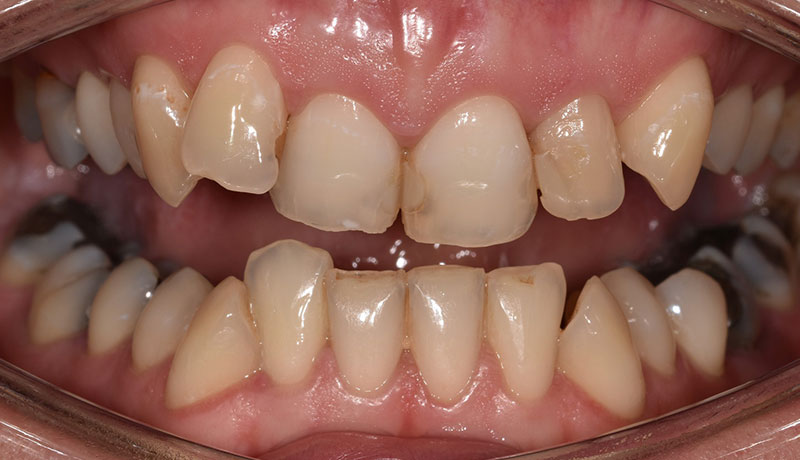 Orthodontics | Treatments | The Priestgate Clinic