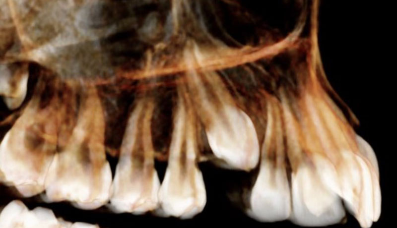 Oral Surgery | Treatments | The Priestgate Clinic