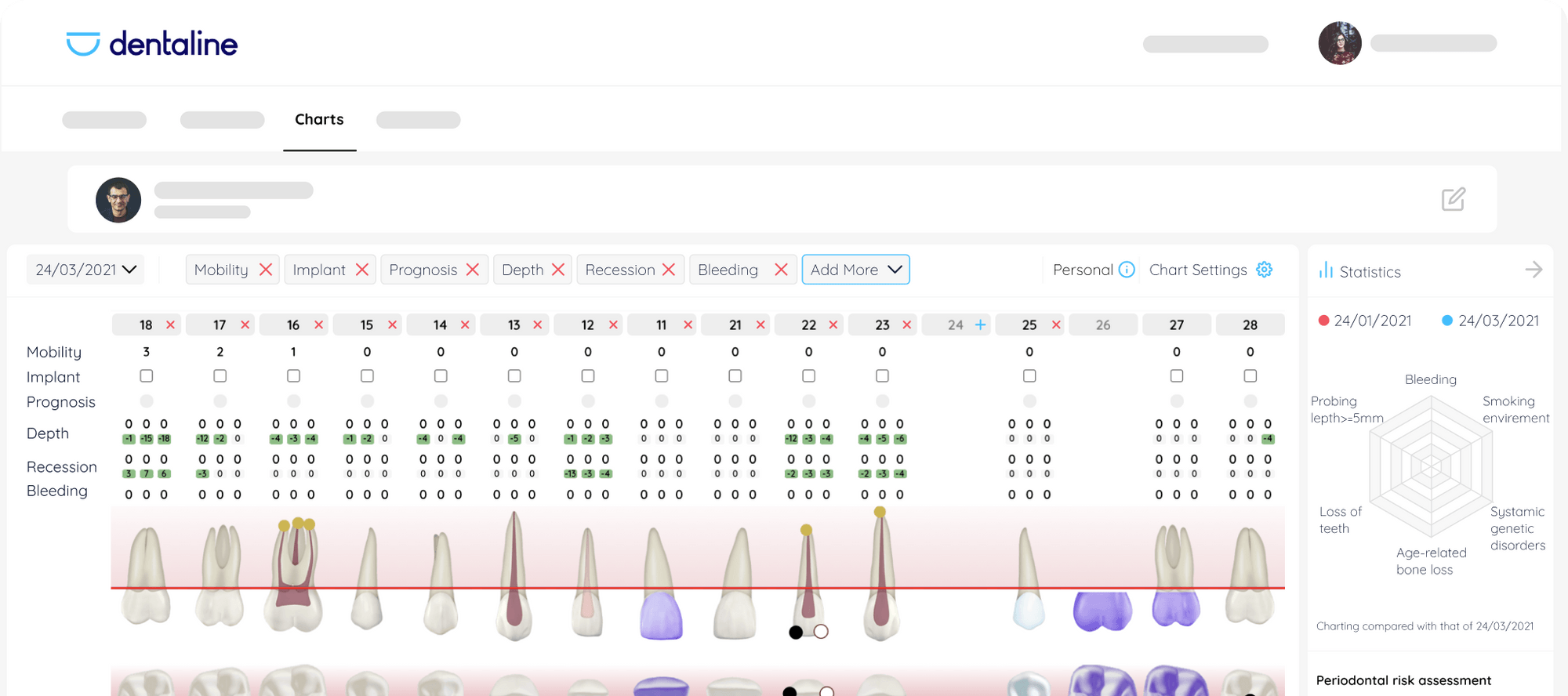 Dentaline - Periodontal and Odontogram Charting