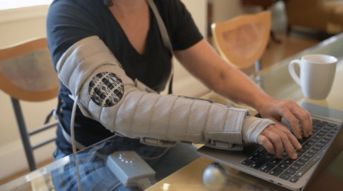 A New Lymphedema Treatment | Dayspring Therapy