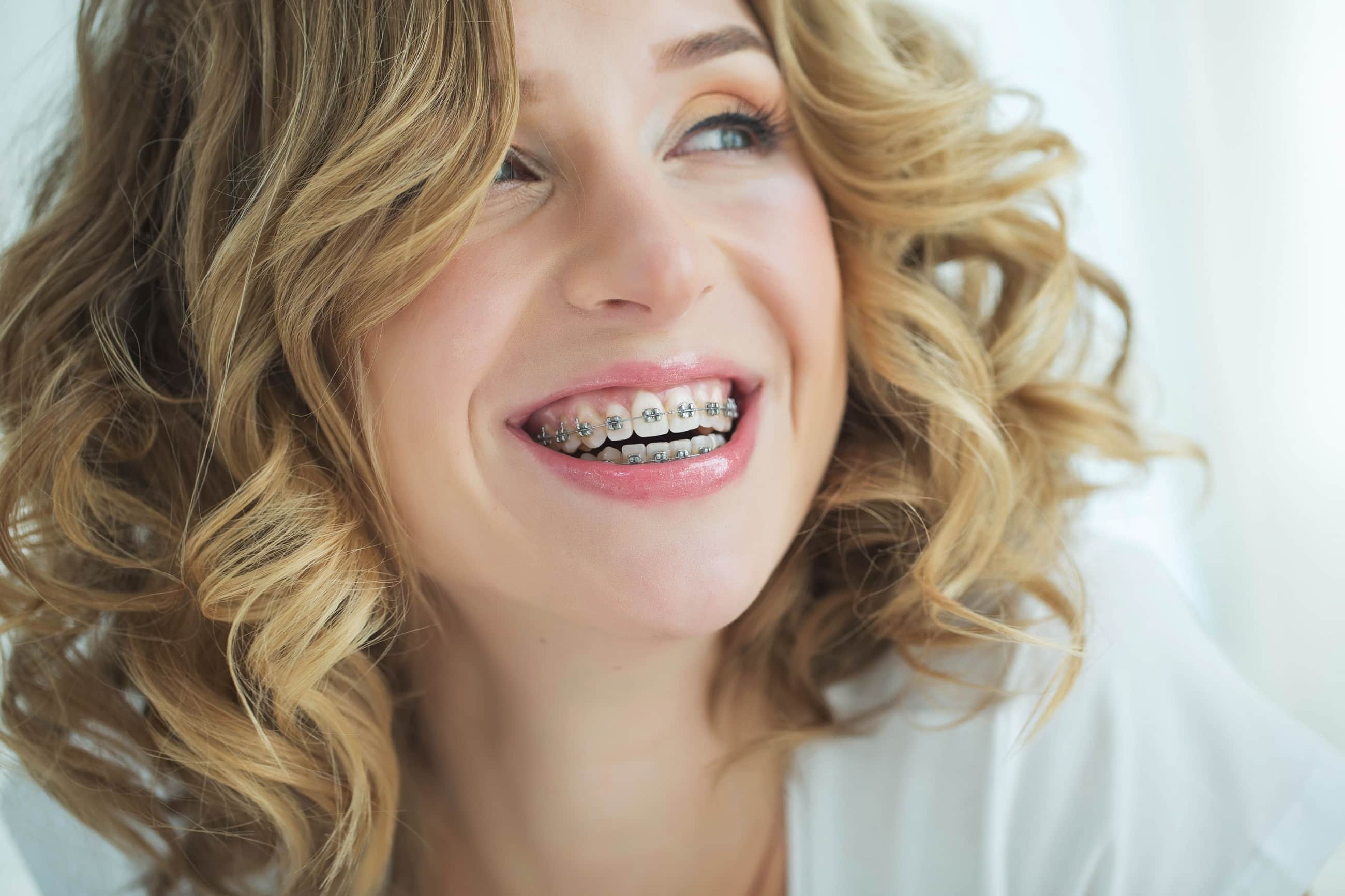 Fixed Braces | The London Orthodontic Group