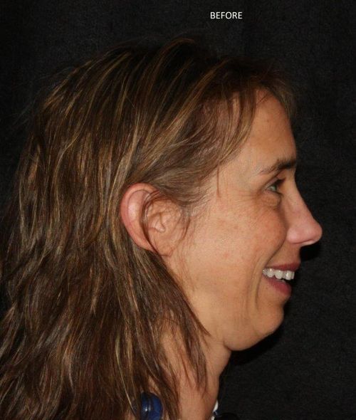 Photo Gallery 2 | Makowski Dental