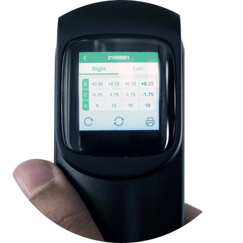 Remidio Instaref R-20 | Portable Autorefractometer