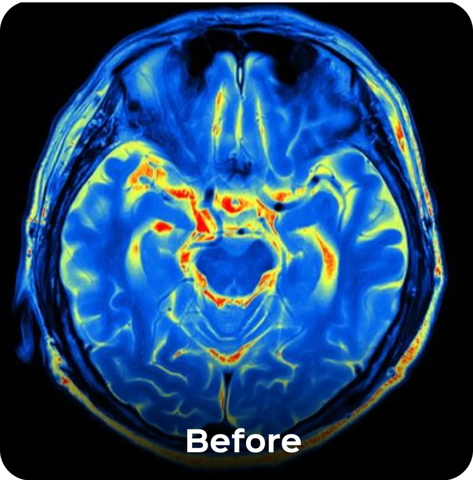 Live Online Pranayama & Breathwork Classes | Pranayama Yoga