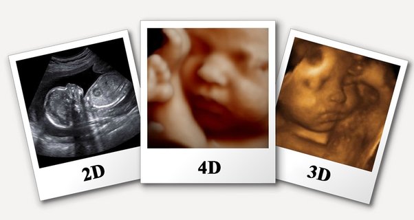 Lux Radiology | 3D/4D Pregnancy Bonding Scans