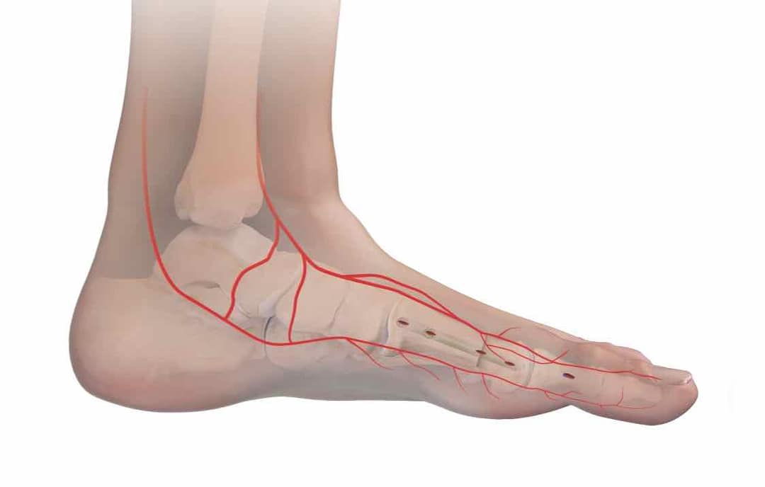 Bunion Correction Surgery | Arthrex Bunionectomy