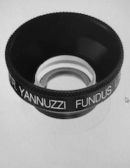 Yannuzzi lens - Museum Artifiacts