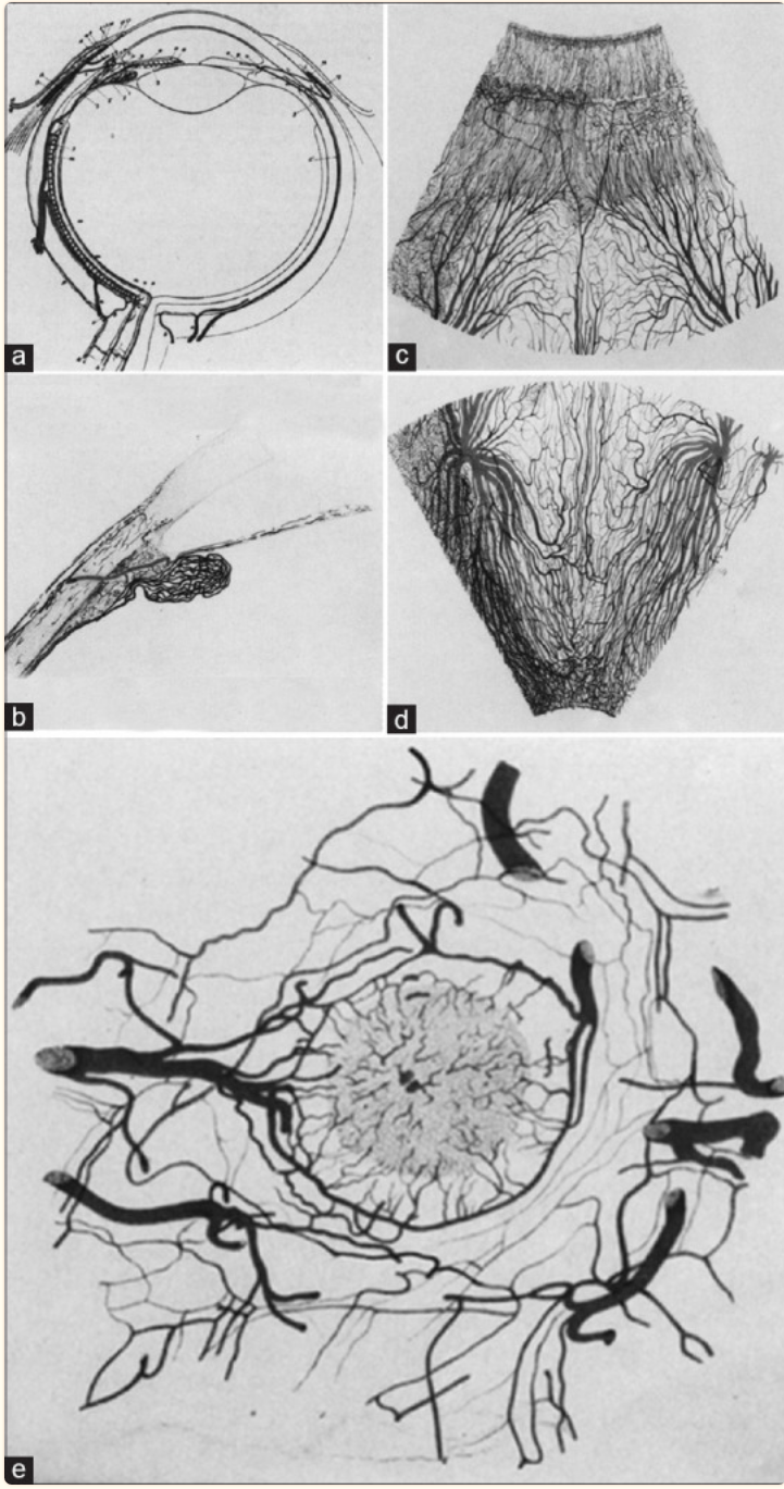 Theodor von Leber History of Retina