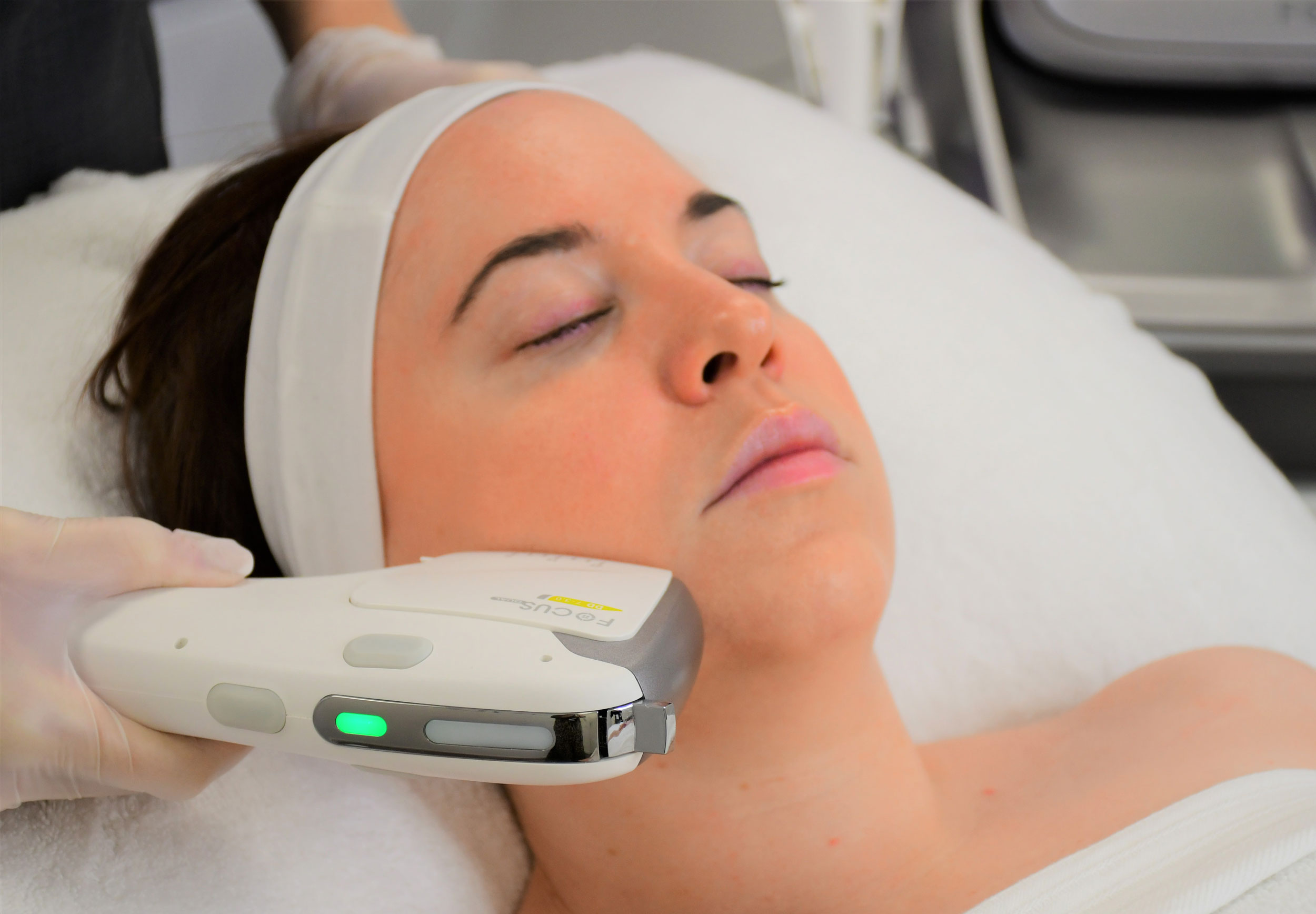 Non Surgical Face Lift Hifu at Naomi Marshall blog