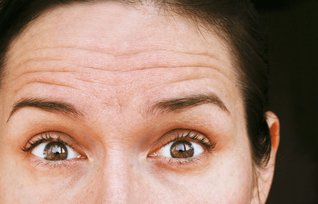 Skin Aging & Wrinkles | Treasure Valley Dermatology | Dr. Dustin Portela