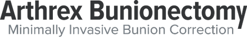 Arthrex Bunionectomy | Minimally Invasive Bunion Correction
