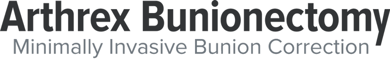 Arthrex Bunionectomy | Minimally Invasive Bunion Correction