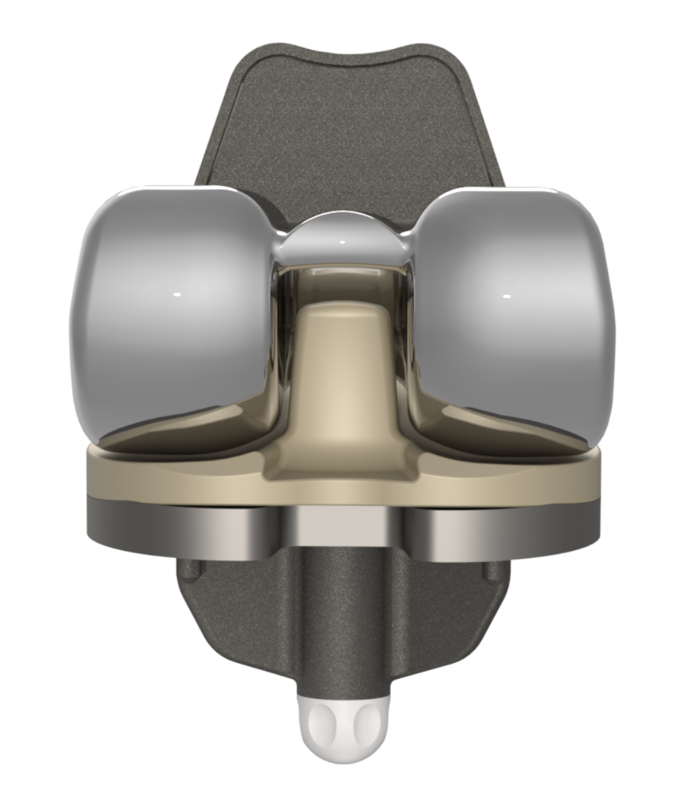 Klassic® Knee System | TJO - Total Joint Orthopedics