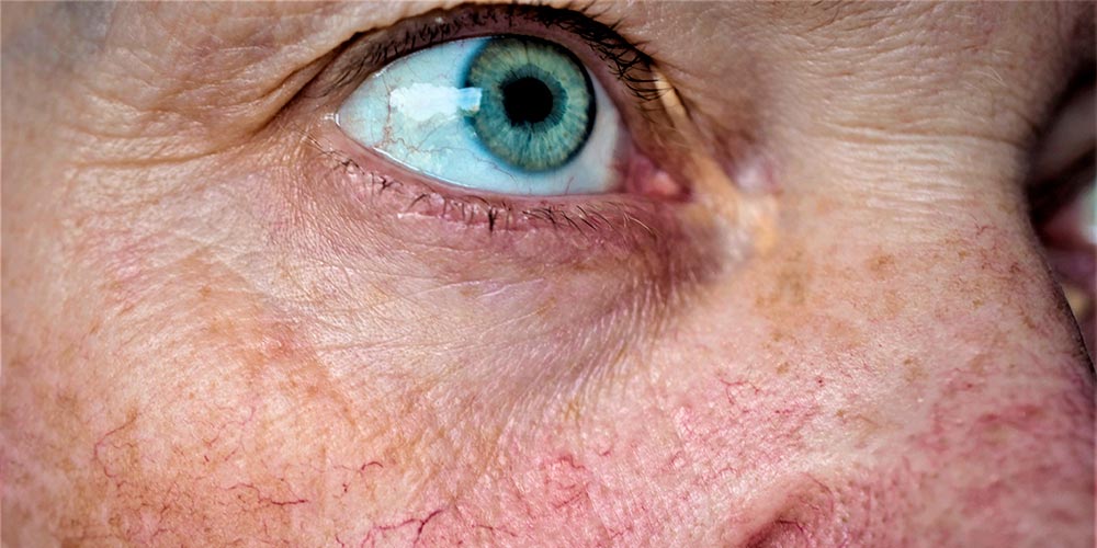 Veinwave Treatment Clinic For Spider Veins, London UK