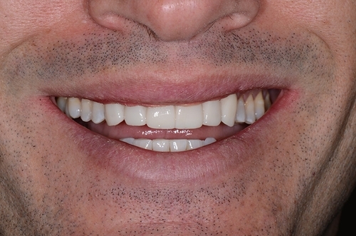 Smile Gallery | Smile Wellness Co.