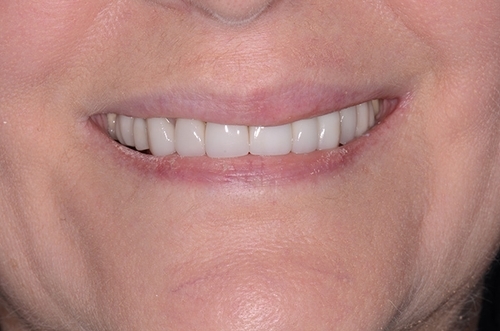 Smile Gallery | Smile Wellness Co.