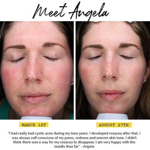 Results - Skin Laundry