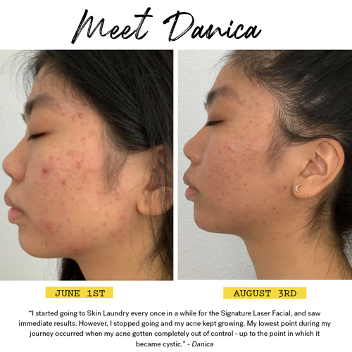 Results - Skin Laundry