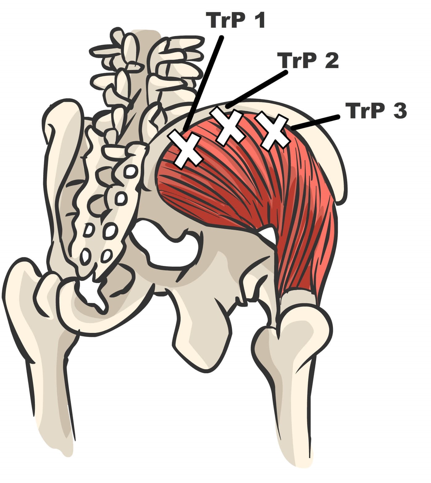 RBM Exclusive | Gluteus medius of middelste bilspier