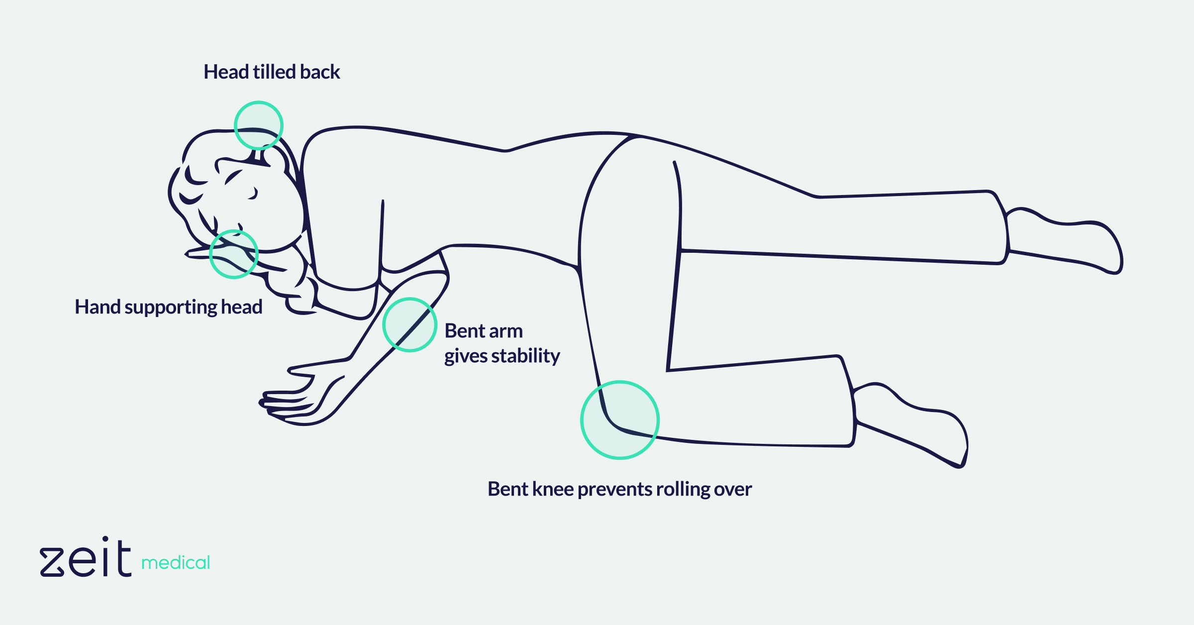 How To Help A Stroke Victim Emergency And Long Term Steps