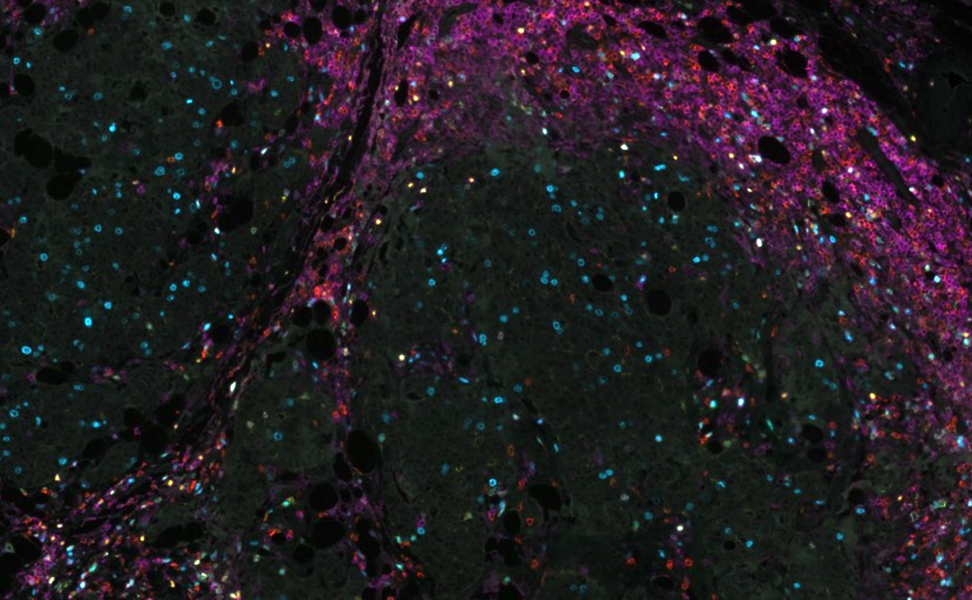 Lunaphore Comet Spatial Proteomics