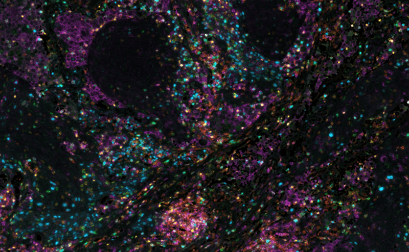Lunaphore Comet Spatial Proteomics