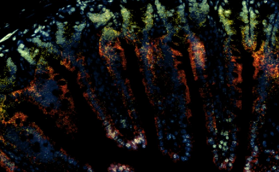 RNAScope In Situ hybridization