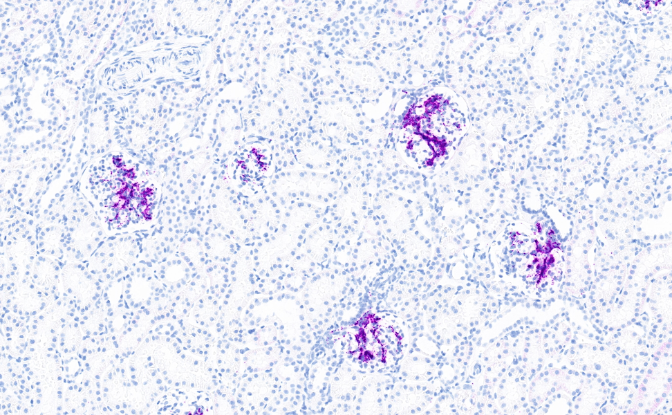 RNAScope In Situ hybridization