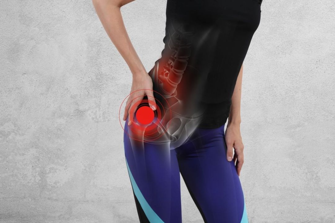 Gluteal Tendinopathy - A real pain in the butt! - Insights | Pro-Active ...