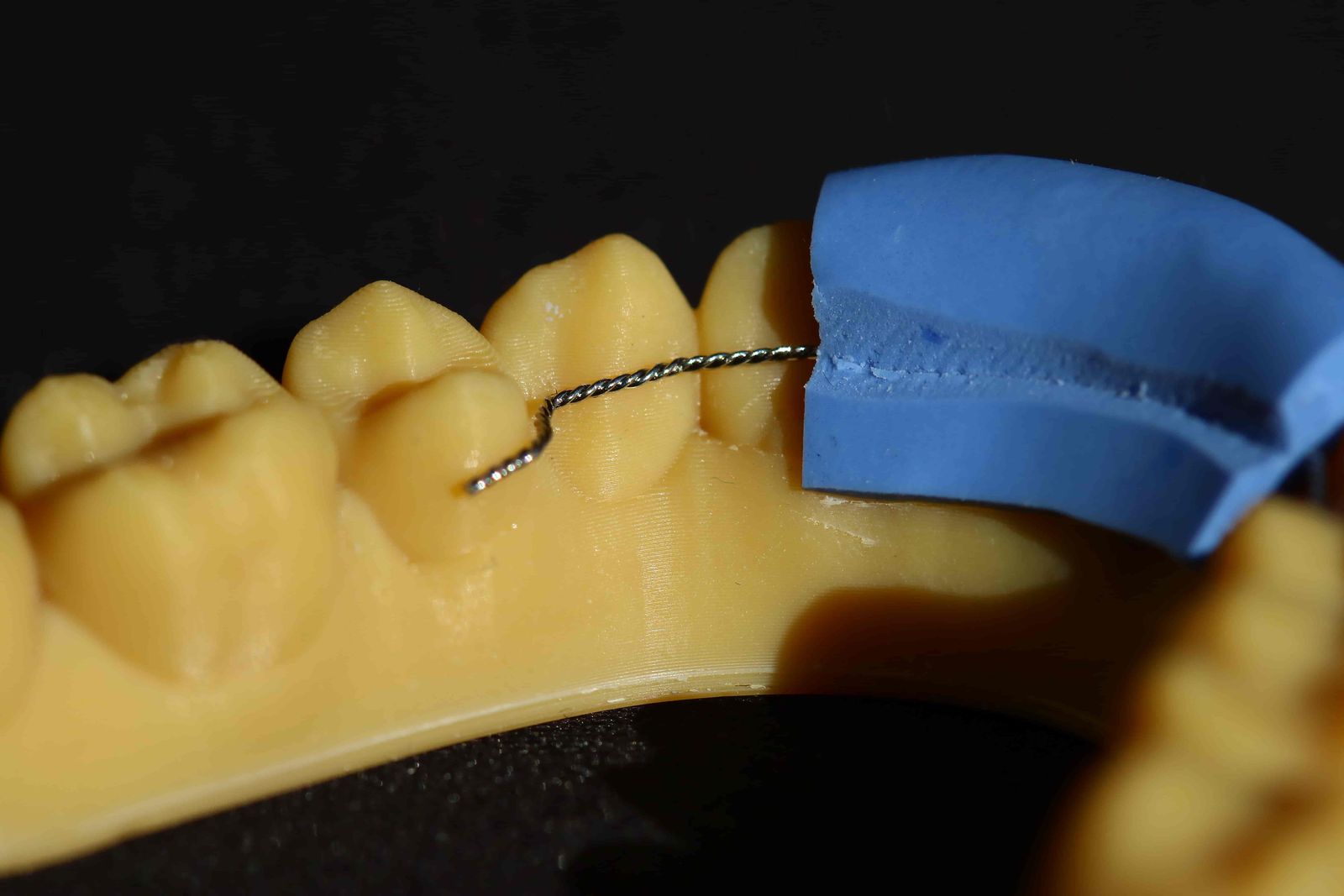 Primo, une large gamme de contentions orthodontiques numériques