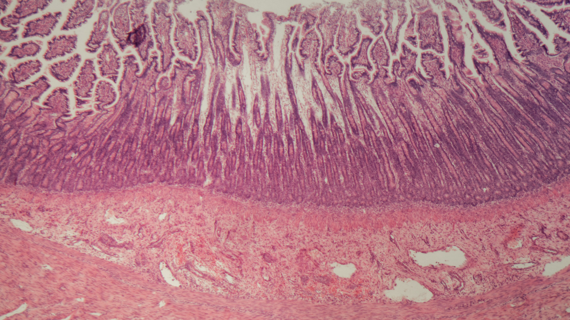 How to Get Rid of 'Bubble Guts' - Çava Health