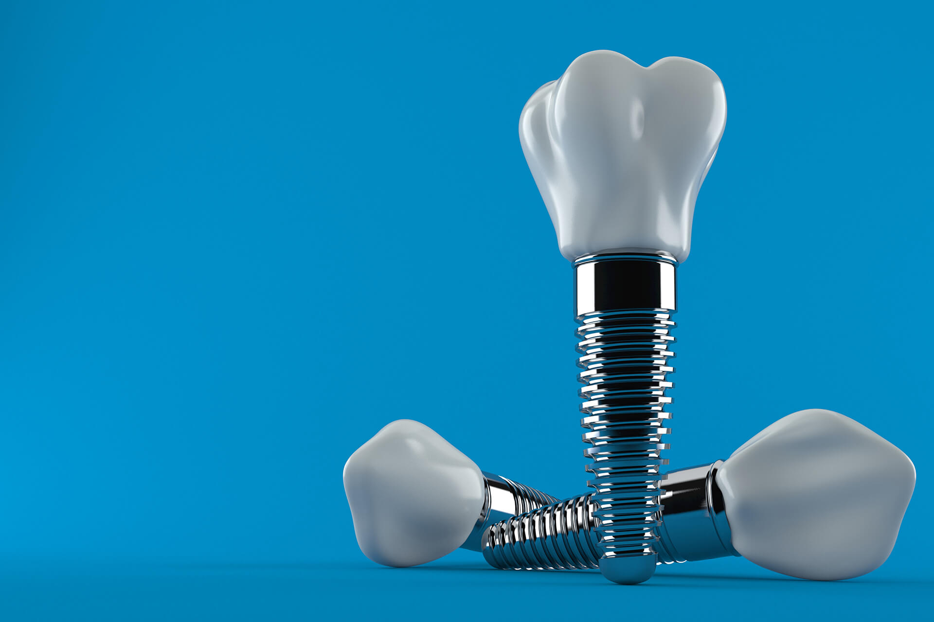 Dental Implant Restoration in Denver, CO - Southeast Denver Dental