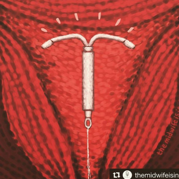 Fertility Clinic & IVF Doctors East Melbourne | Dr Alex Polyakov