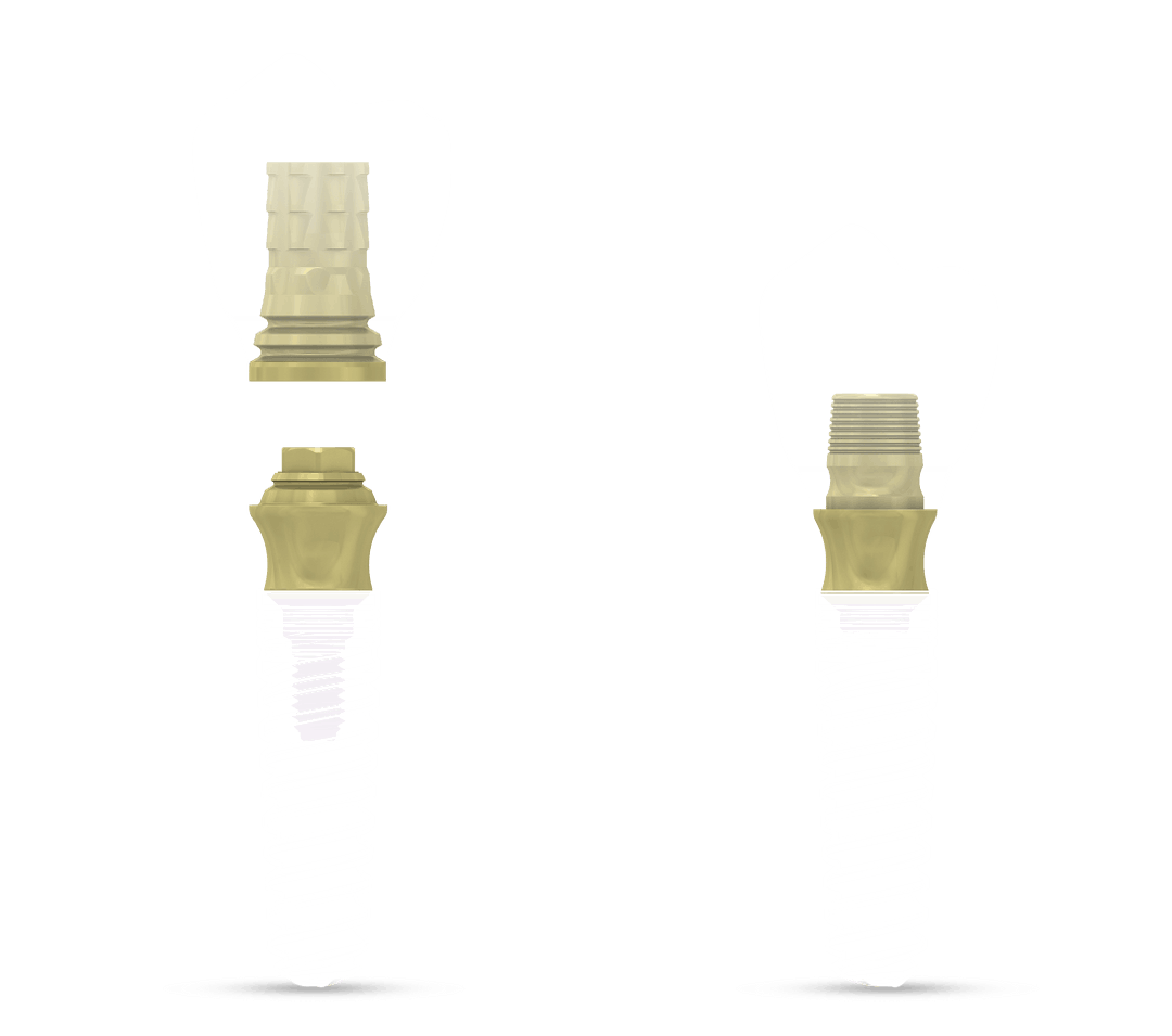 MIS Digital Restoration: Multiple Teeth
