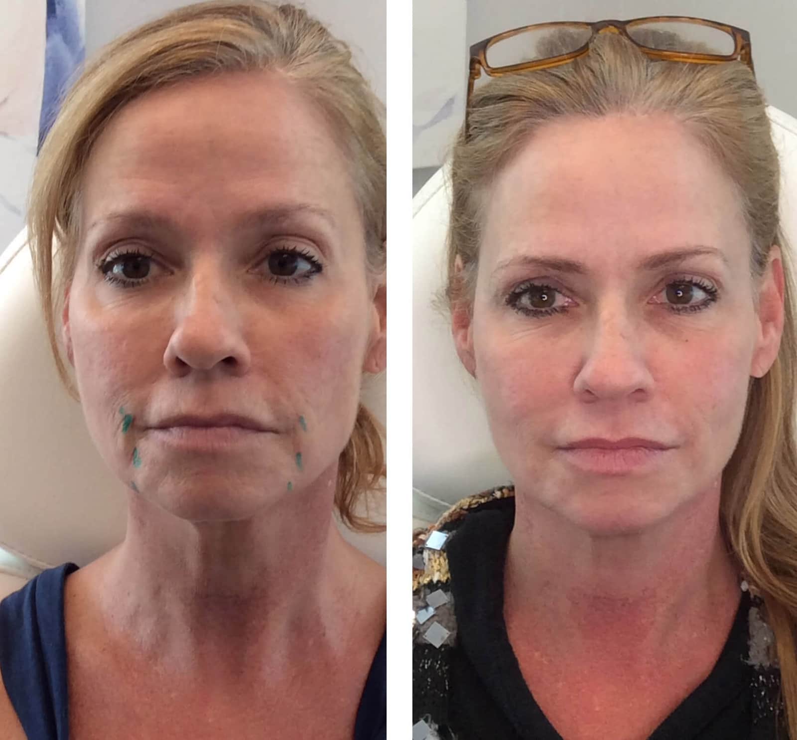 Rejuvenation Med Spa in Boynton Beach, FL